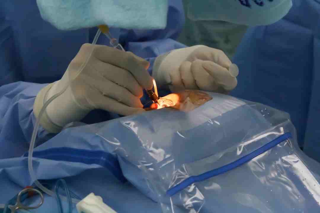 Cataract Surgery Archives - MD Health Clinic